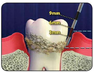 Dental News and Views: Evidence Based Periodontal Treatment