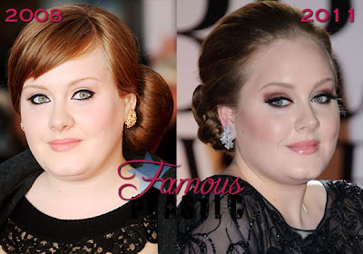 Adele Plastic Surgery Nose Job Before and After (Star plastic surgery)