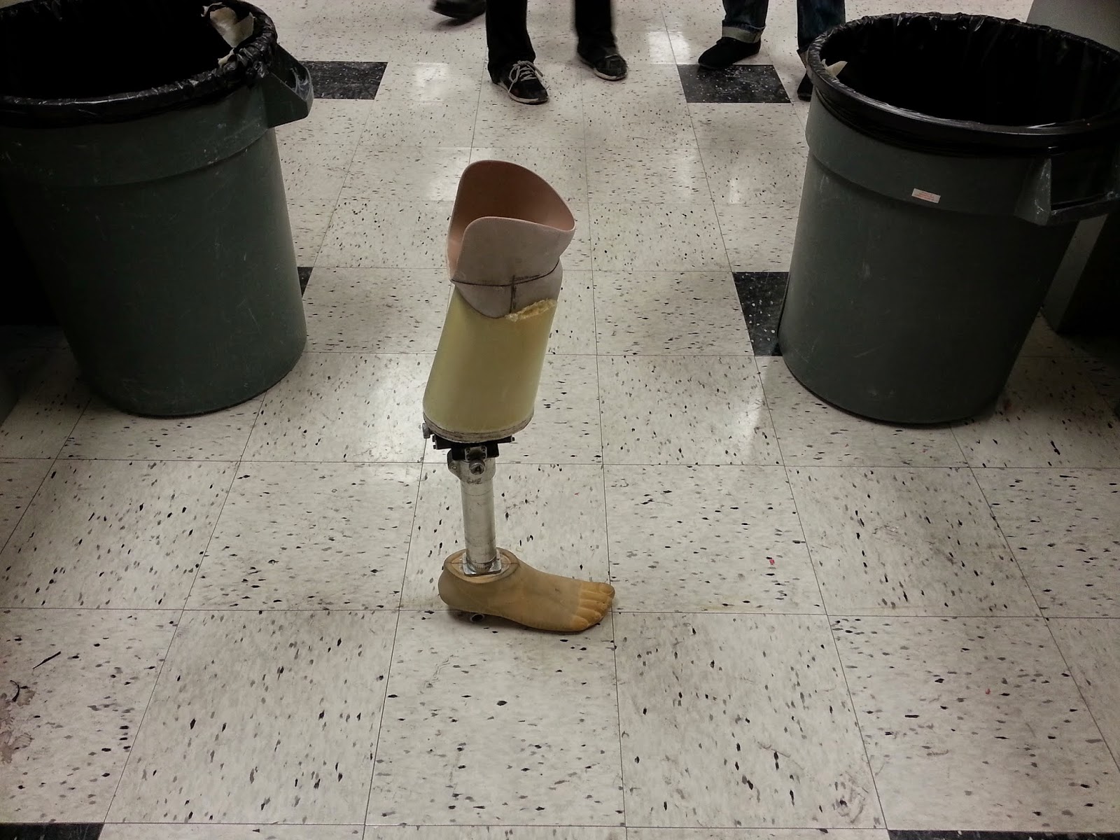 Prosthetic Projects: PTB Exoskeletal Prosthesis