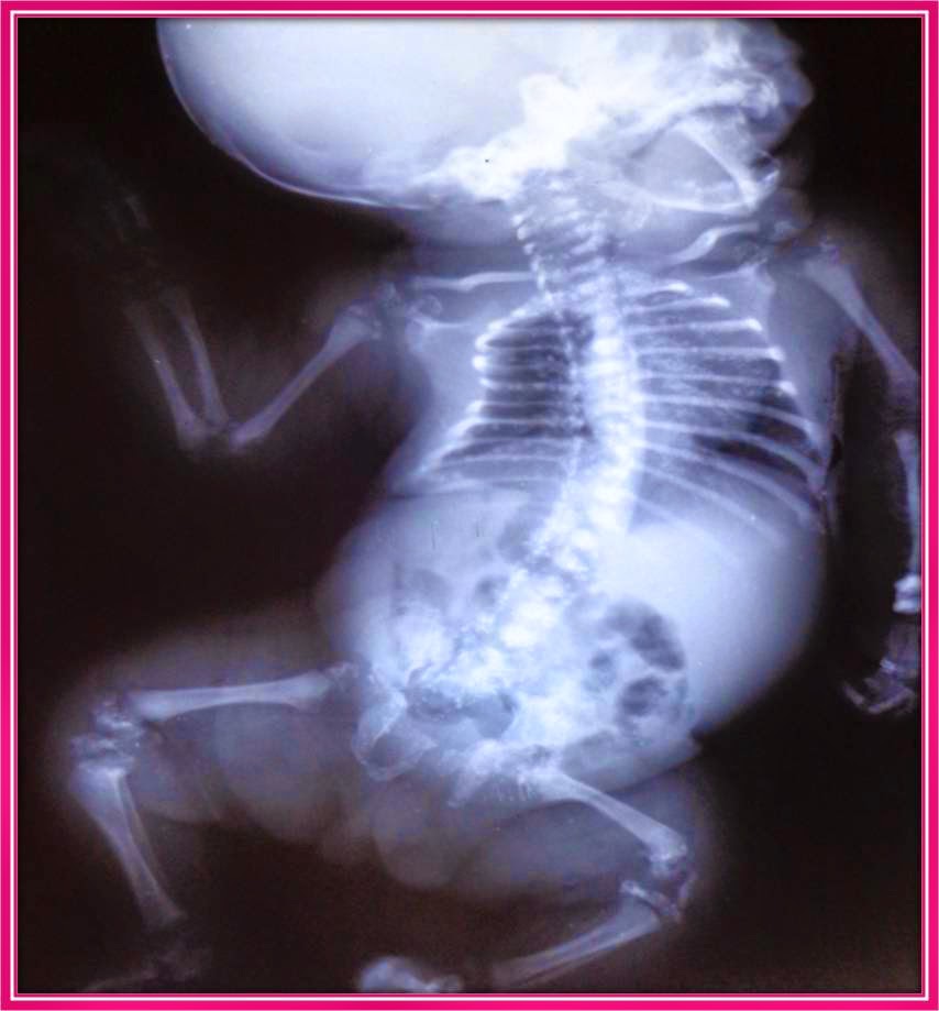 RADIOLOGY IMAGE SPOTTERS: Conradi Hunerman