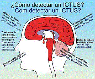 FISIOMÓNICA: Día Mundial del Ictus: ¿Por qué importa?