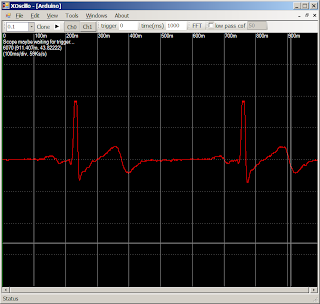 Coding Laboratory: Minimal ECG using an Arduino and Xoscillo