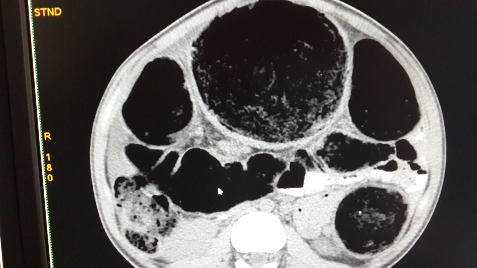 EL RINCÓN DE LA MEDICINA INTERNA. juanpedromacaluso@yahoo.com.ar ...
