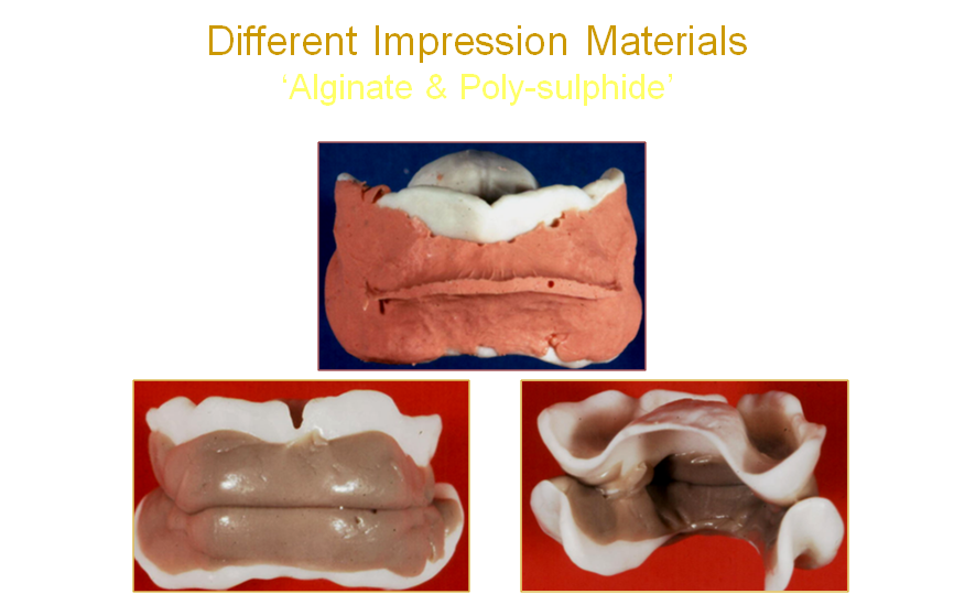 Dentistry and Medicine: Concept of Neutral Zone