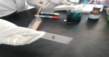 Archivos de Laboratorio Clínico : Método de KATO-KATZ