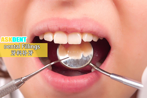 Ask.DentistMY 牙牙学医: Are you getting a dental fillings? What to expect ...