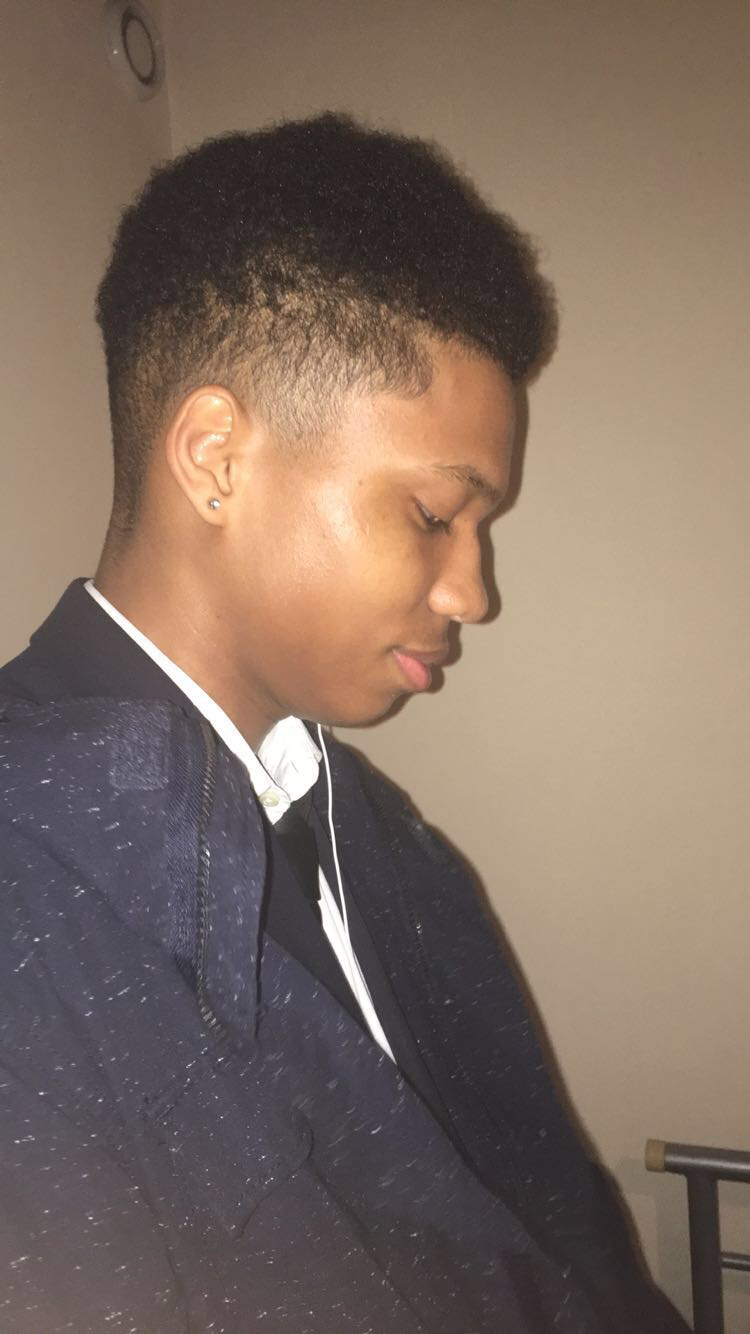 How Tongue Posture Changes Your Facial Structure Making You More ...