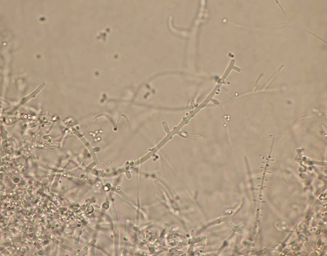 ATLAS MICOLOGIA: TRICHOPHYTON MENTAGROPHYTES