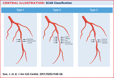 松下 ER ランチ・カンファレンス: SCAD スキャッド