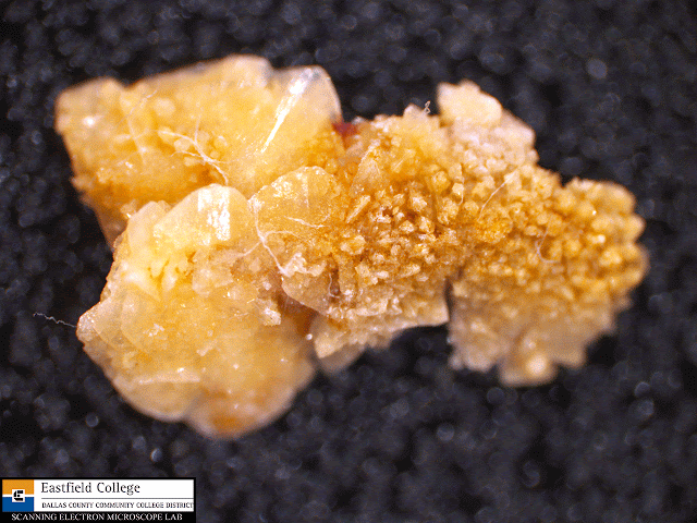 Scanning Electron Microscope Blog: A Kidney Stone - OUCH!!