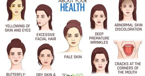 Health is Wealth: What Your Face Tells You about Your Health