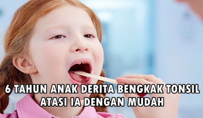 6 TAHUN ANAK DERITA BENGKAK TONSIL,ATASI IA DENGAN MUDAH