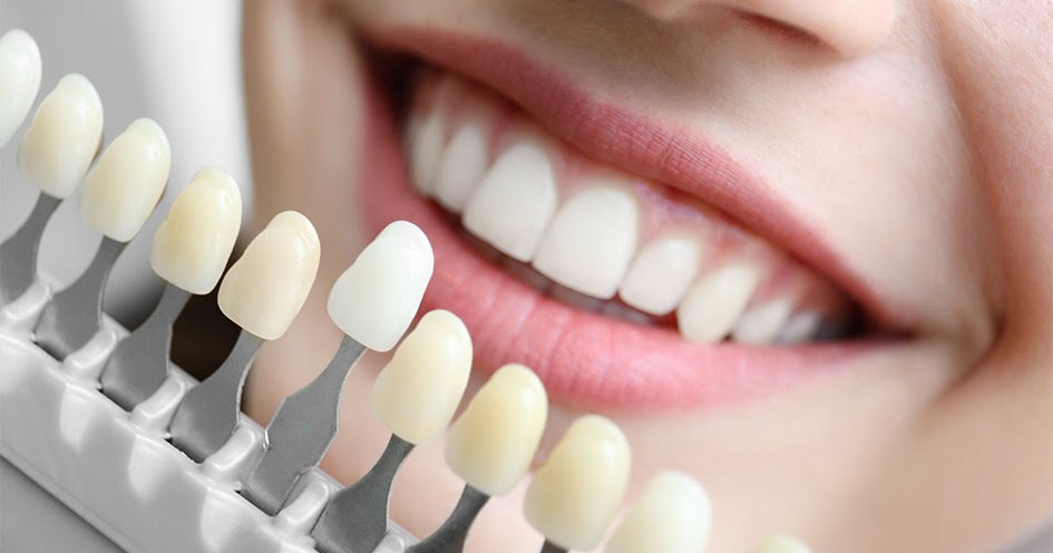 What is tooth color restoration? How tooth colored filling restore your ...