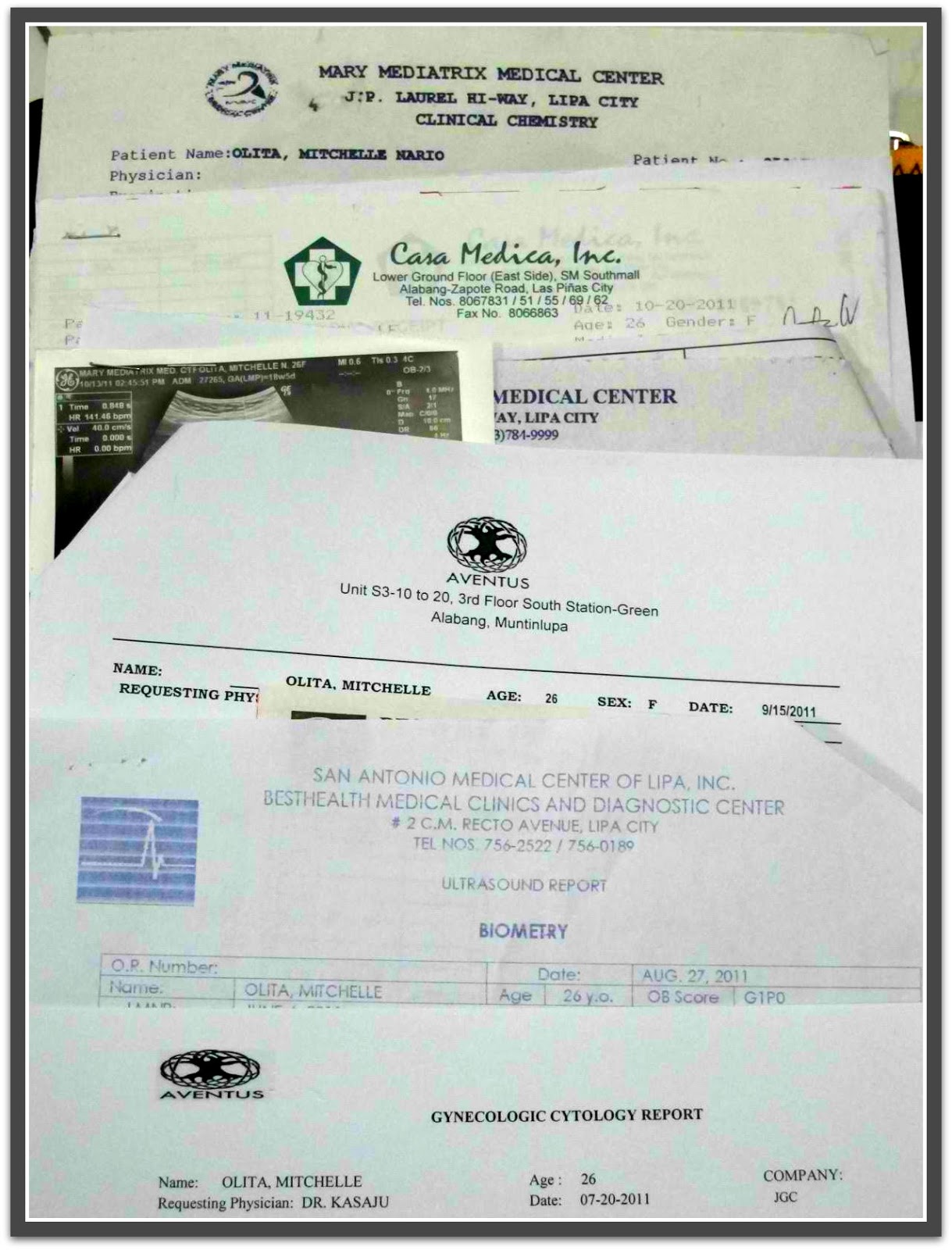 fecalysis - philippin news collections