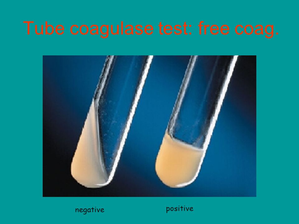 SENTHIL PRABHU SIVASAMY: Staphylococcus aureus