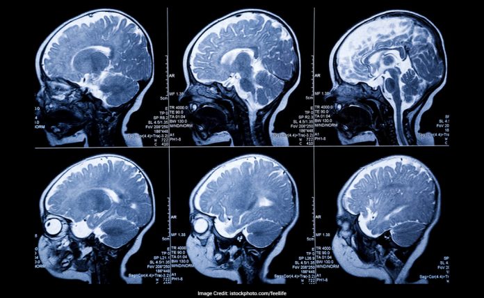 Wessam Bou-Assaly: Autism and Brain MRI