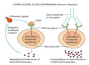 Graves Disease - Symptoms, Causes, Diet, Diagnosis, Treatment
