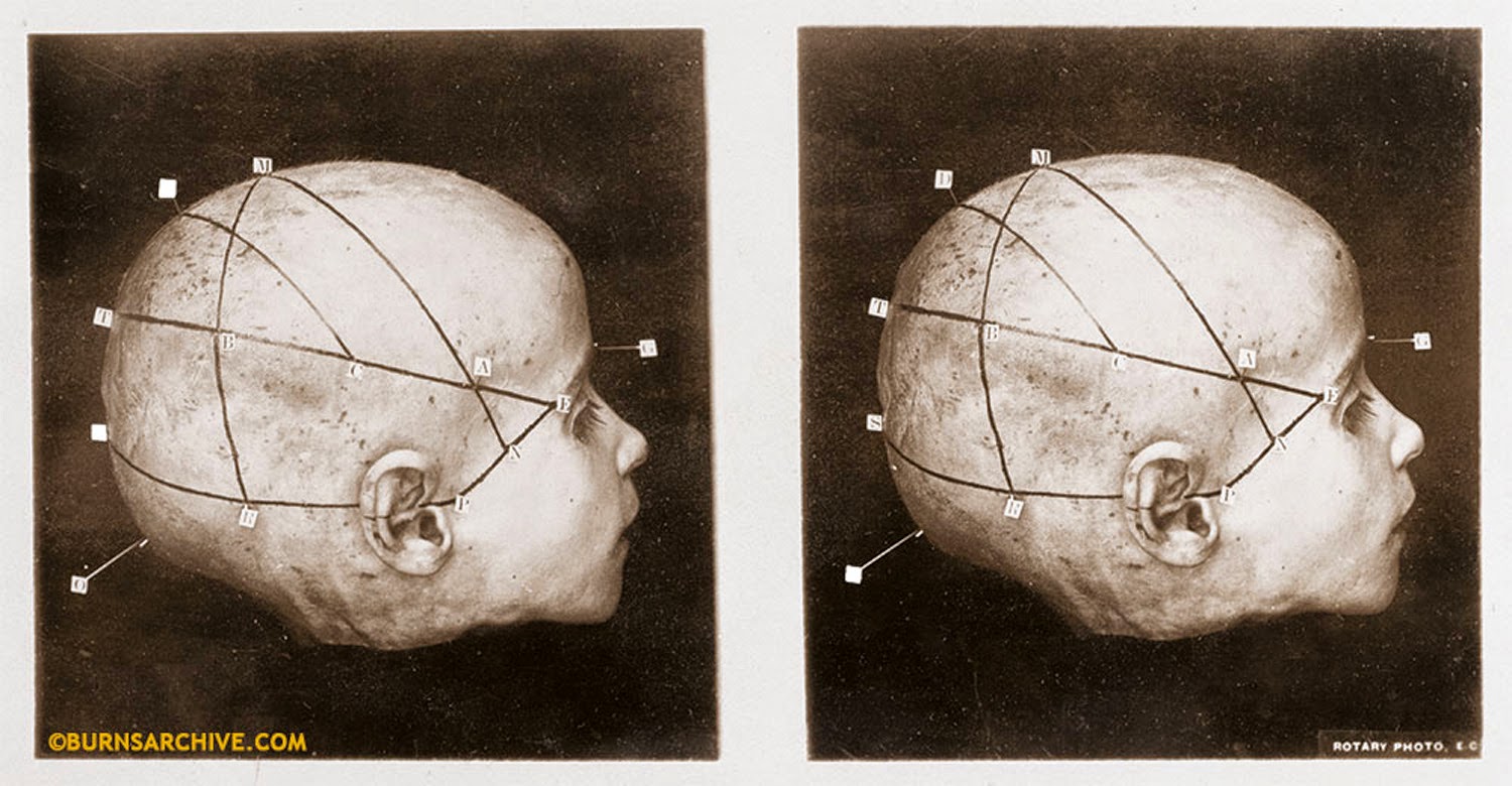 Rare and Weird Vintage Photos of Skeletons and Dead Bodies ~ Vintage ...