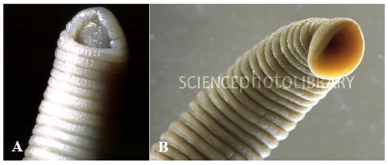 Embryology in the Qur’ān: The head of the embryo resembles a Leech’s sucker