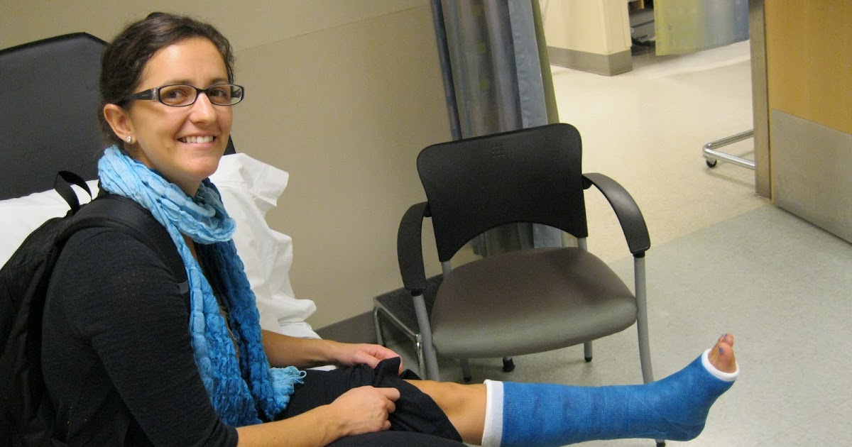 PTCaster: SLC (Short Leg Cast)