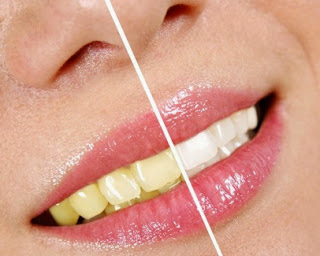 Oroville Gentle Dentistry: Why Are My Teeth Yellow?