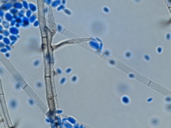 Fun With Microbiology (What's Buggin' You?): Pleruostomophora richardsiae