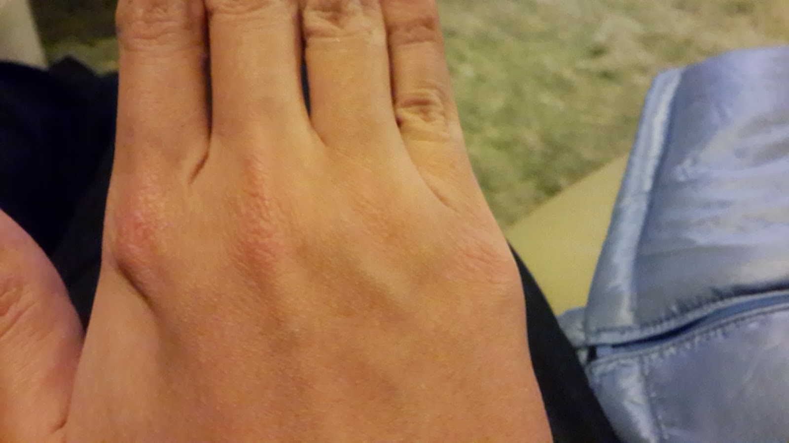 L.I.F.E - Learning Intensively For Everyday: Skin Crack Experience - A ...