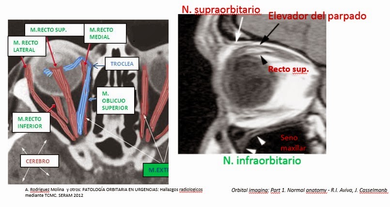 ESPE 202 - 2014: Anatomía y patologías de la cavidad orbitaria