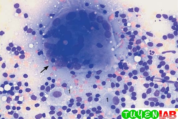 [Haematology] Cytology Atlas of Organ Biopsies and Exudates | Free ...