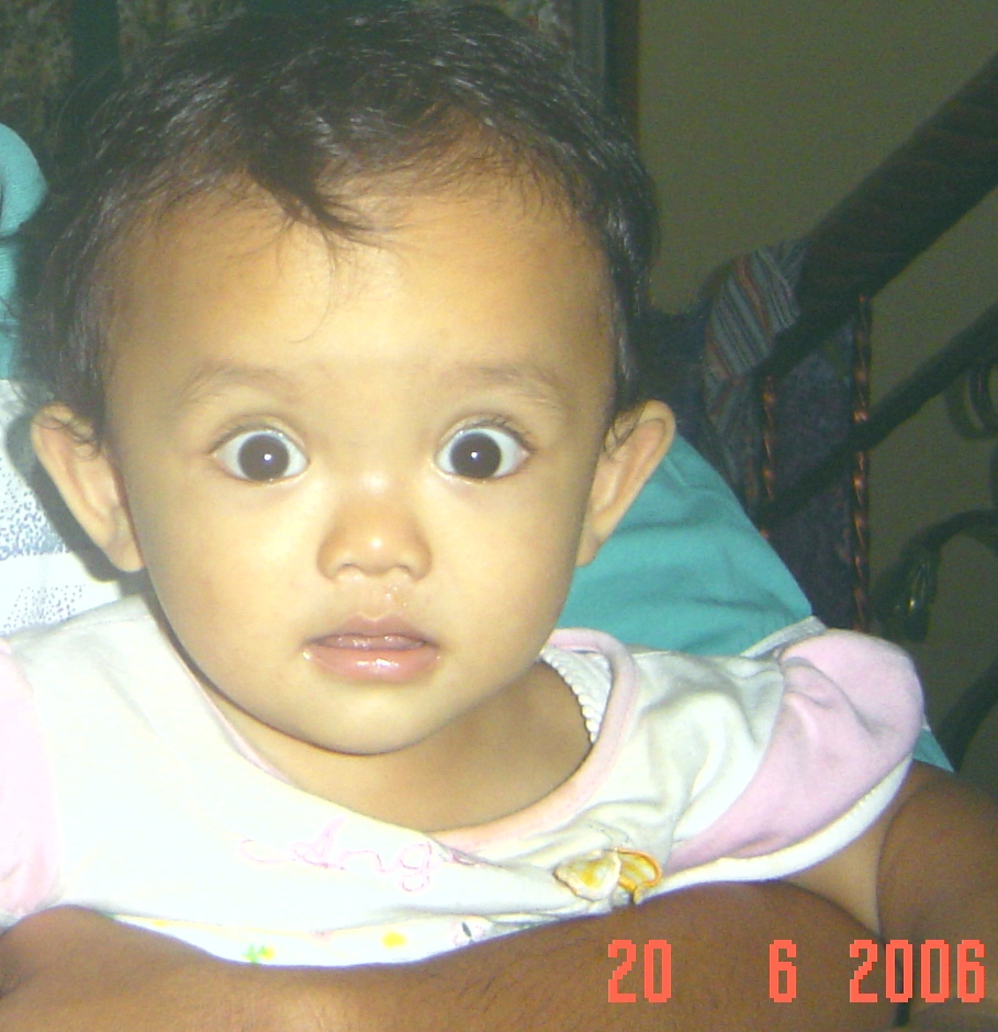 Langkah-langkah Kecilku: Mata belo