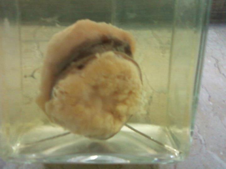 Medical Education for Students: Gross Specimens General Pathology (50 ...