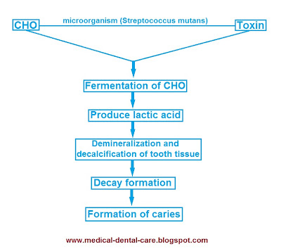 Caries Mechanism Formation and Pathology - Medical and Dental Care