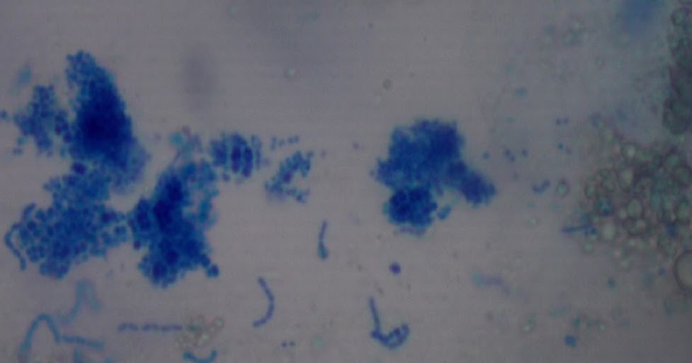 Micro-World: mucus with bacteria