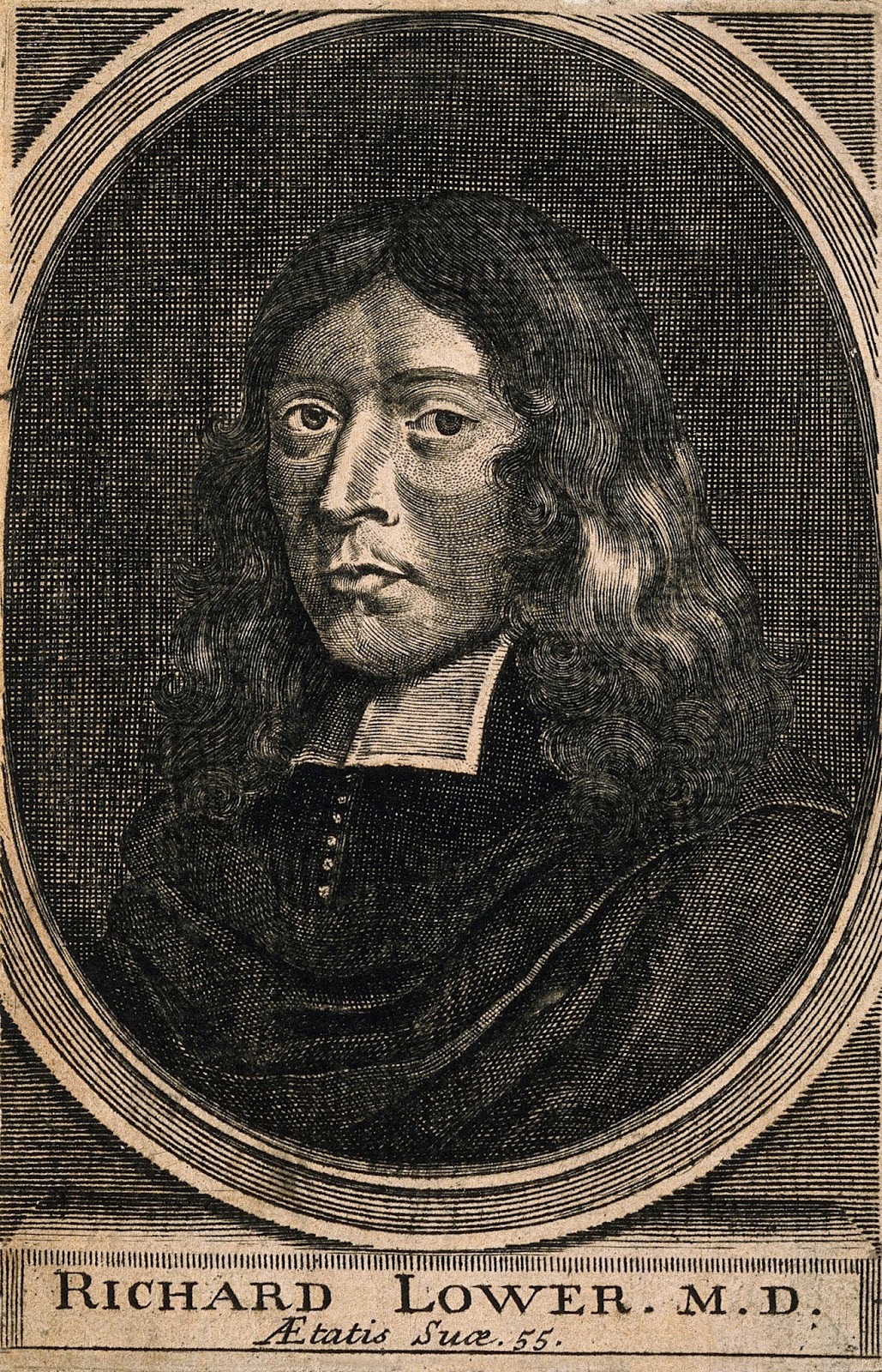 Enroque de ciencia: Primera transfusión sanguínea