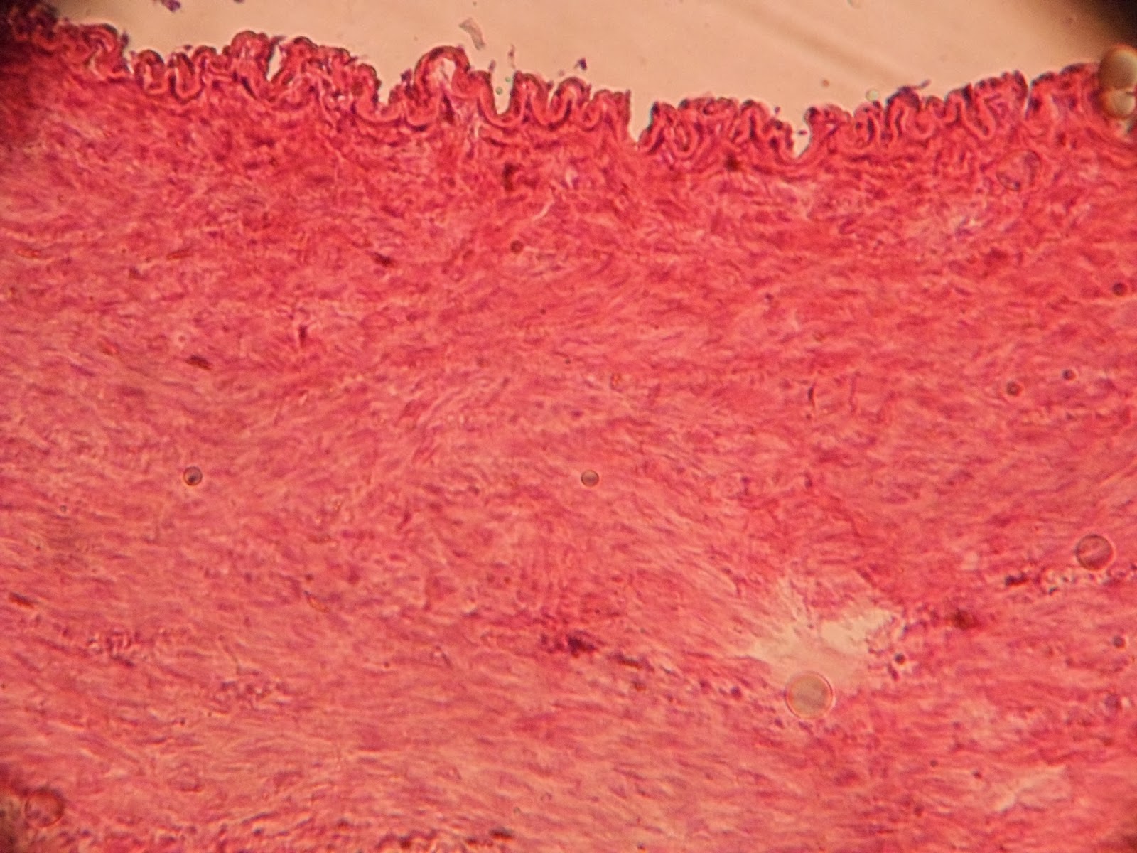 LA GALERÍA MICROBIOLÓGICA: Endotelio y Fibra Elástica