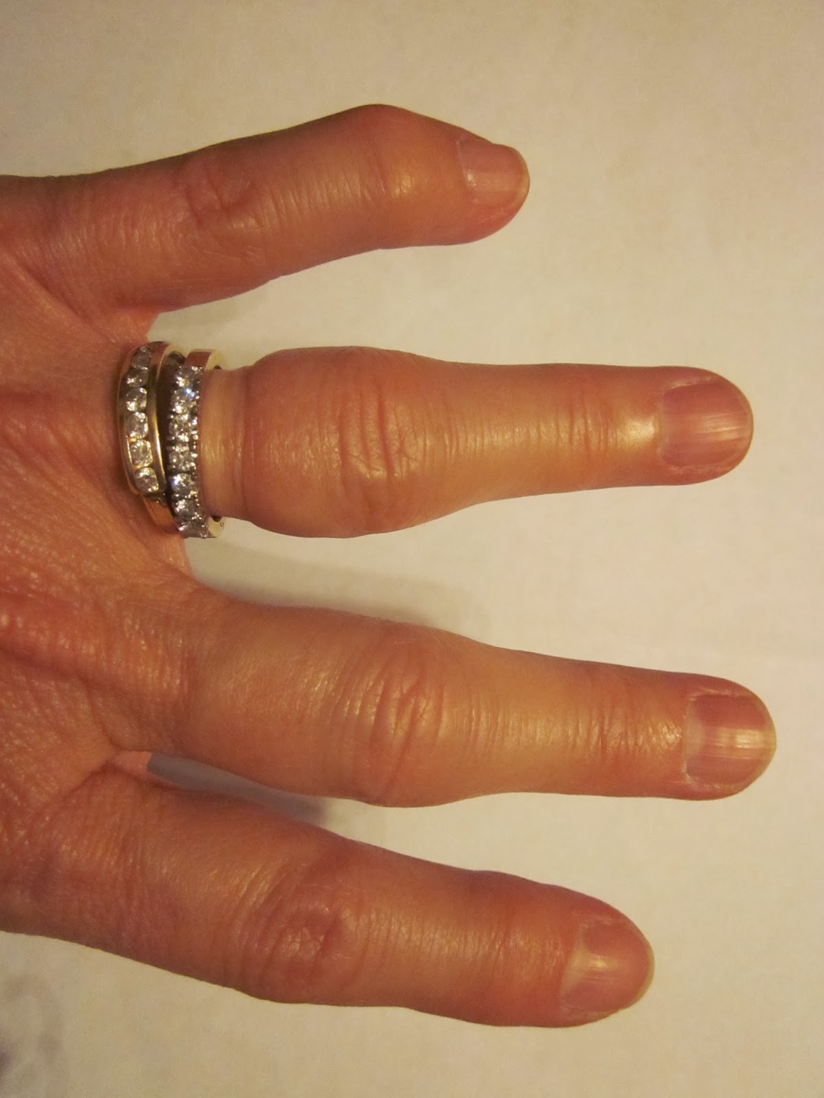 Shuffle, Scrap, Sparkle: Arthritis...A painful way of life