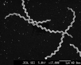 Opiniones de Leptospira