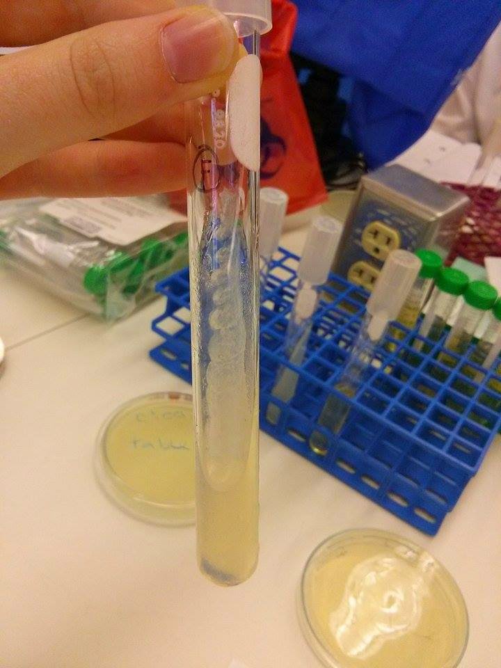 Nursing Adventures: Medical Microbiology: Day 2: Streaks and Stains