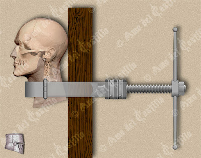 AMO DEL CASTILLO: GARROTE VIL. Tipos y funcionamiento