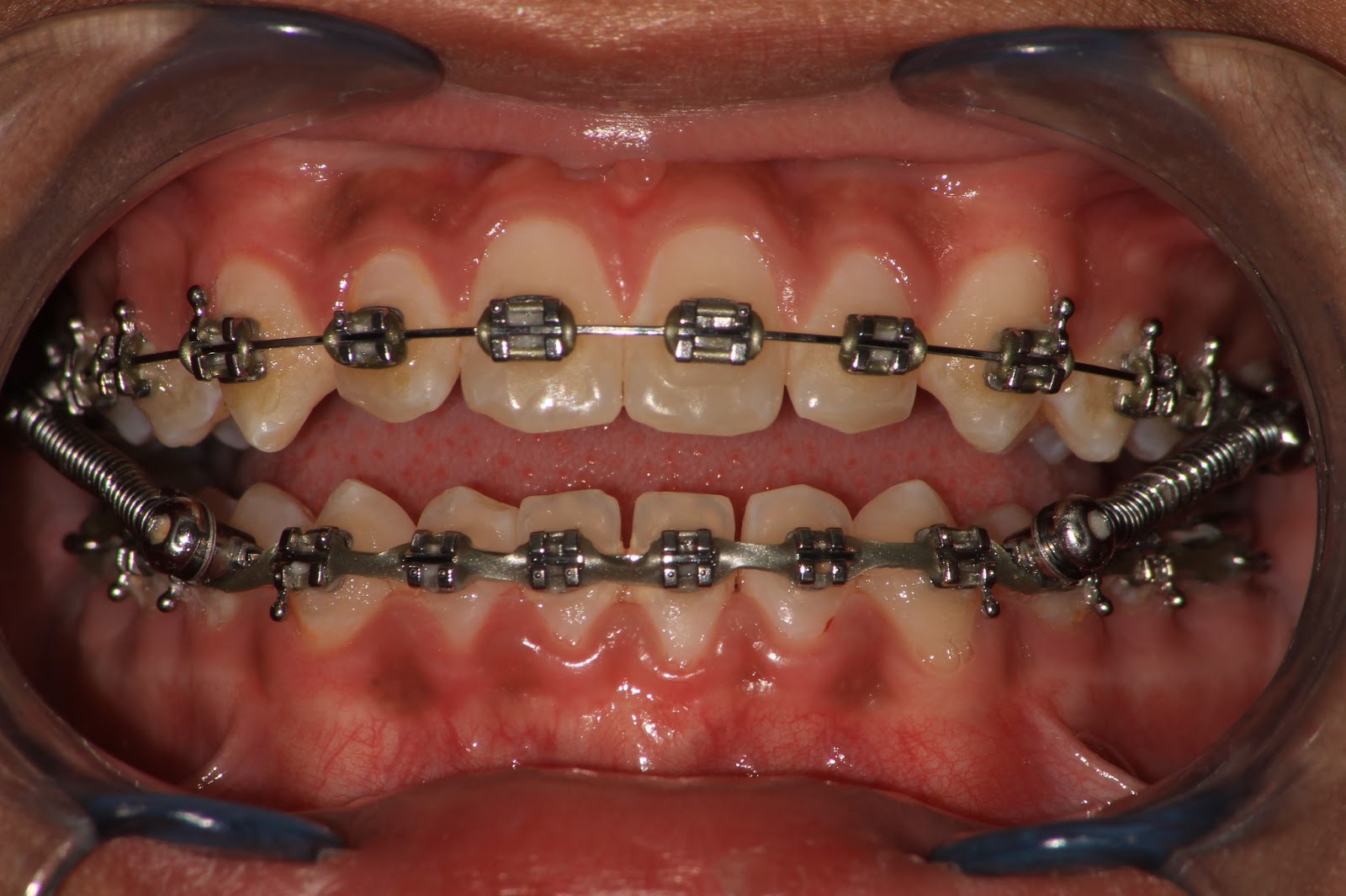 Ramin Mehregan D.M.D.