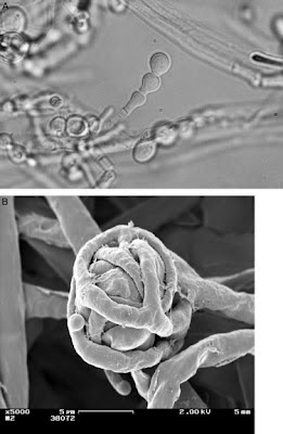 Curiosidades de la Microbiología: Monascus purpureus, lovastatina y ...