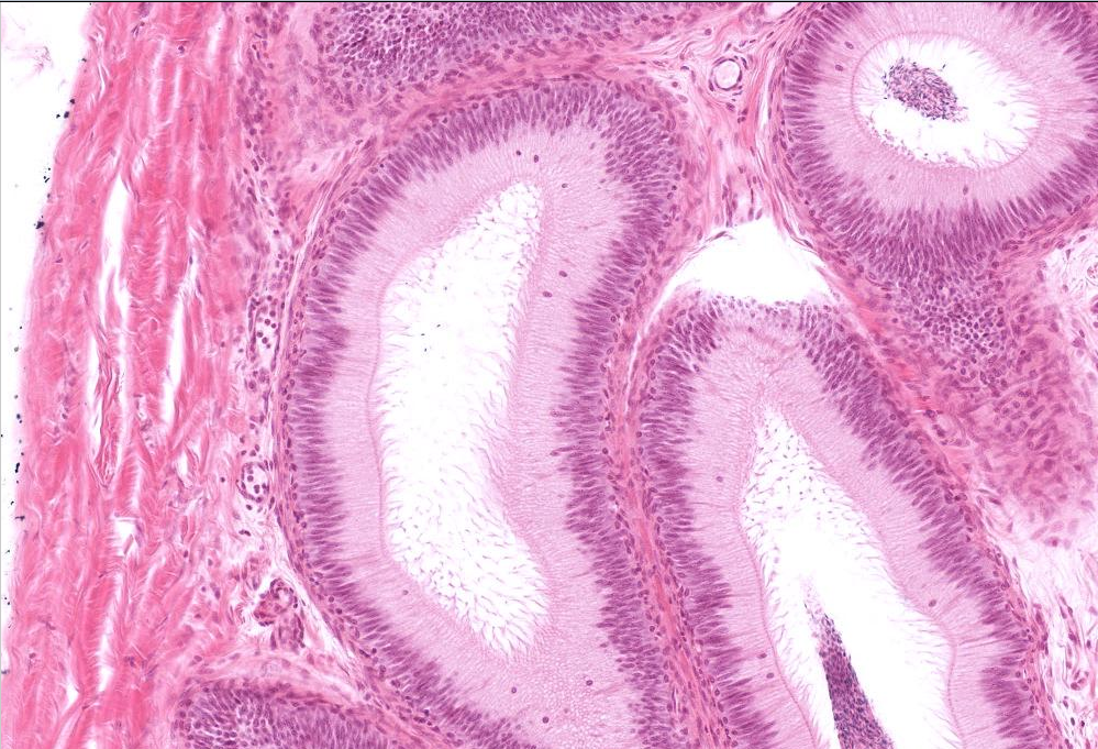 μicroscopia: EPIDIDIMO