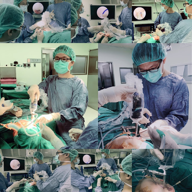 微創顳顎關節盤復位手術(Arthroscopic Discopexy)如何復位？