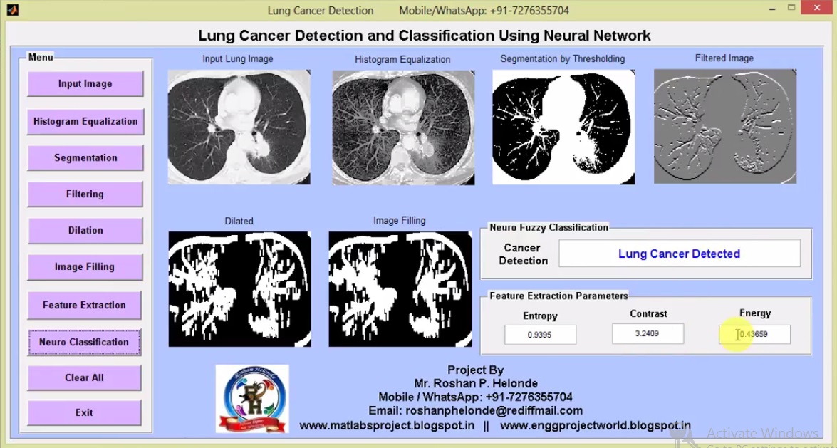 Lung Cancer Detection Using Neural Network Matlab Project With Source Code Ieee Based Project
