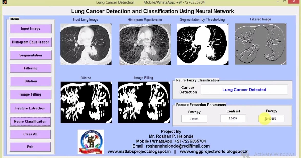 Lung Cancer Detection Using Neural Network Matlab Project with Source Code || IEEE Based Project ...