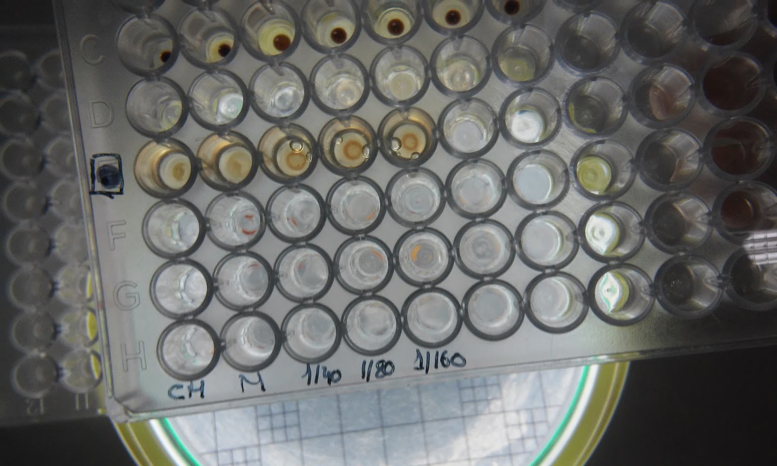 Microbiología: TPHA