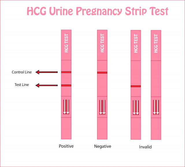 A Guide to HCG Levels and is Importance in maternity - Ovidac 2000 iu ...