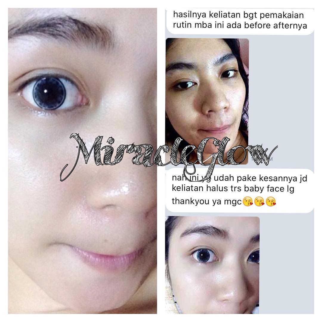 miracle glow platinum