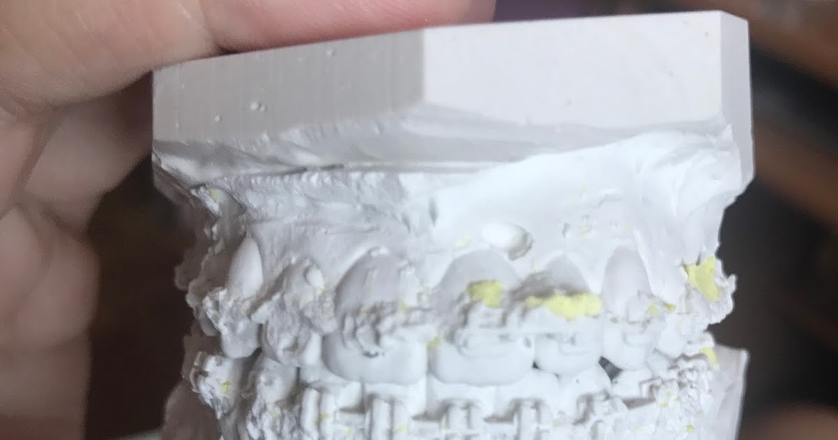 MIMA (Blog and photography): OPERACIJA VILICE