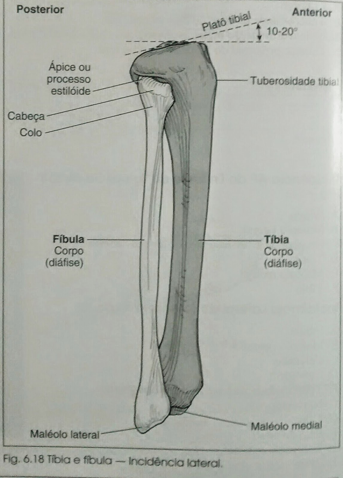 Radiologia Nossa Vida !: PERNA - TÍBIA E FÍBULA